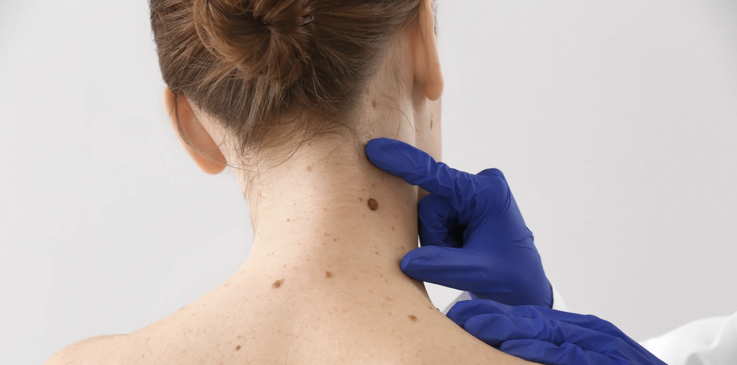 Here’s How to Find the Best Skin Cancer Specialist in Carrollton ...
